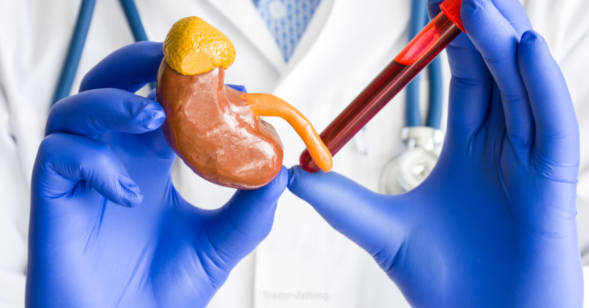 Corcept Therapeutics: Rising Company in the Treatment of Cushing's Syndrome